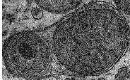 lysosomes - Revista C2